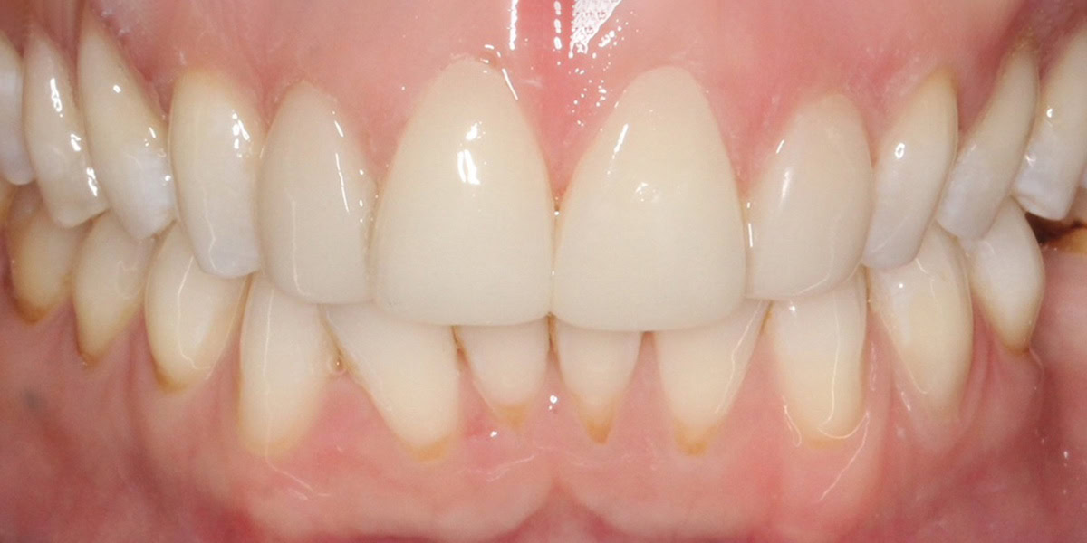 Cosmetic Dentistry Cambridge | Dentistry & More