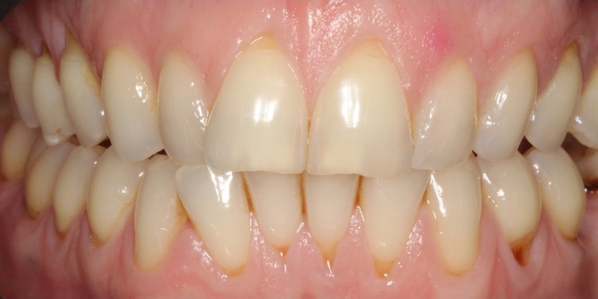 Cosmetic Dentistry Cambridge | Dentistry & More